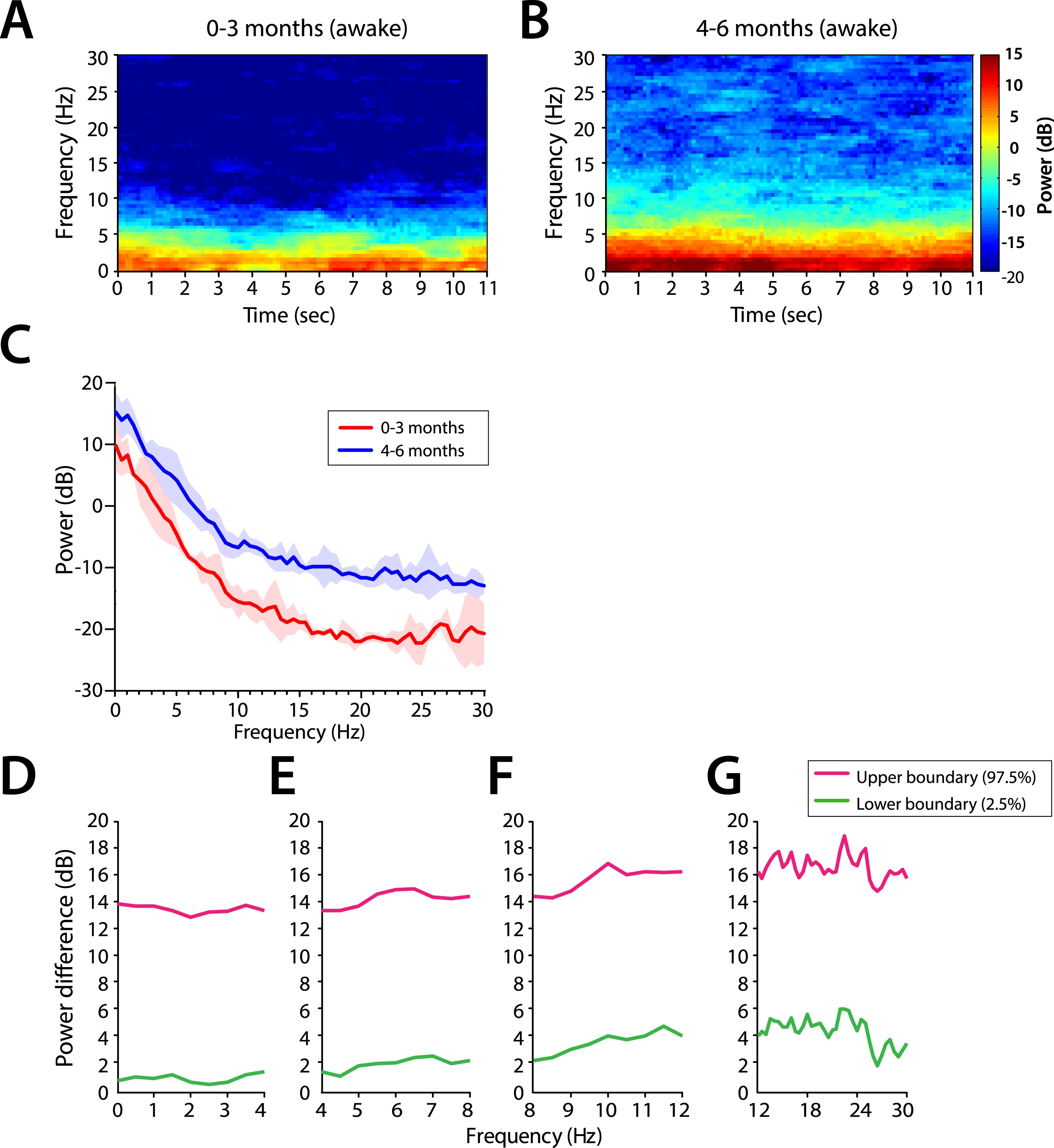 Age-dependent electroencephalogram (EEG) patterns during sevoflurane ...